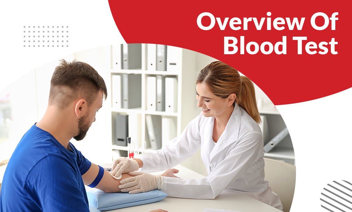 Overview Of Blood Test - Private Blood Tests London
